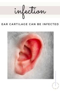 Ear Pain From Sleeping on Side - GONE!